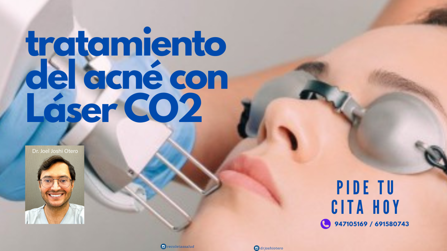 Recomendaciones Posteriores al Tratamiento con Láser CO2 para Acné ...